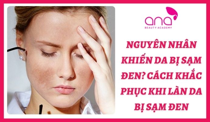 Nguyên Nhân Khiến Da Bị Sạm Đen? Cách Khắc Phục Khi Làn Da Bị Sạm Đen